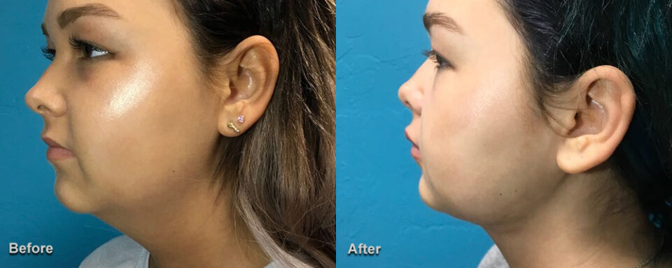 Plastic Surgery Gallery Oklahoma City | Bajaj Plastic Surgery